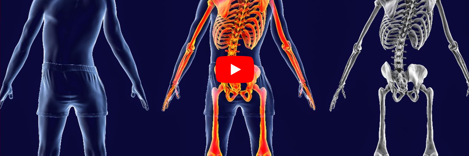 Treating Complex Spine Disorders - Stony Brook Medicine Health News