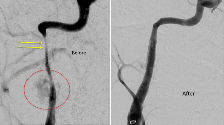 From Trauma to Triumph - Stony Brook Medicine Health News